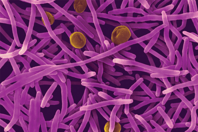 Low Endotoxin Recovery (LER) | Charles River