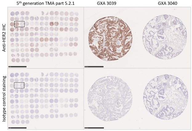 Tumor Microarrays | Charles River