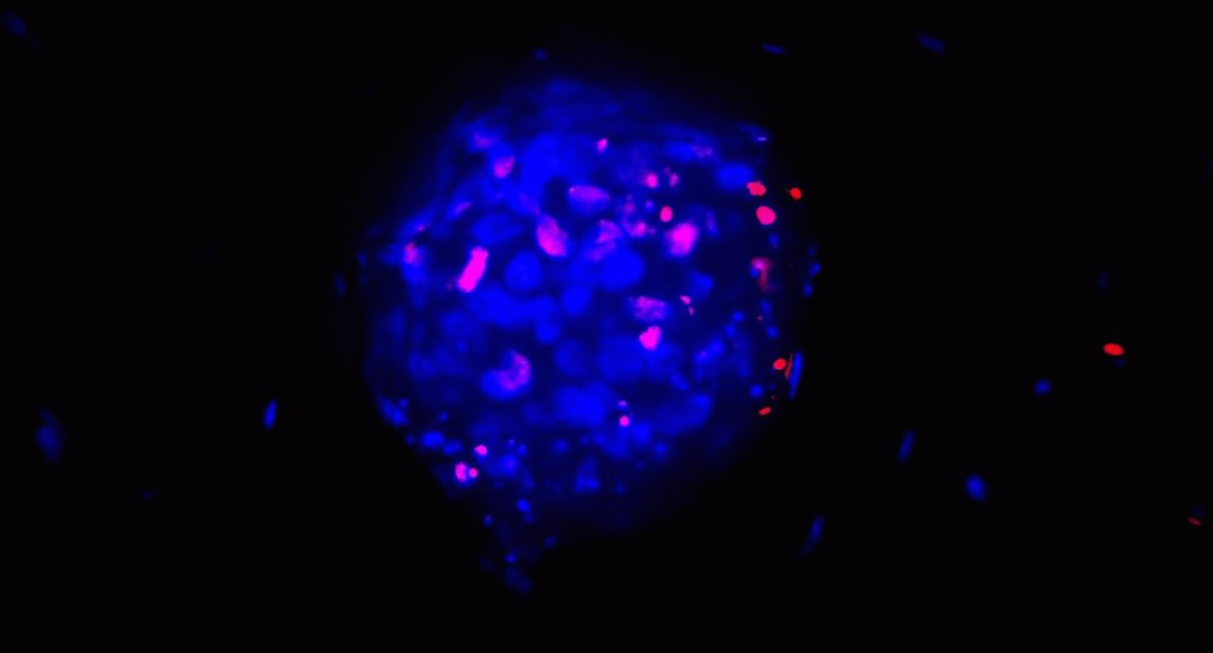 The Integrated World of Small Molecule Oncology Drug Discovery | Eureka ...