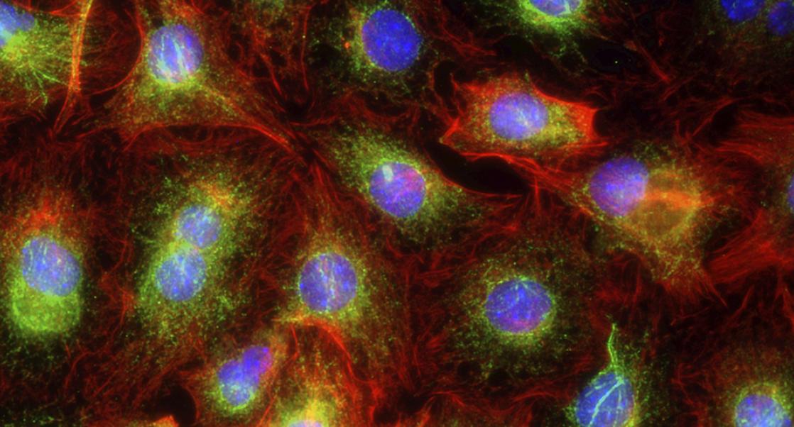 HD in Focus | Charles River